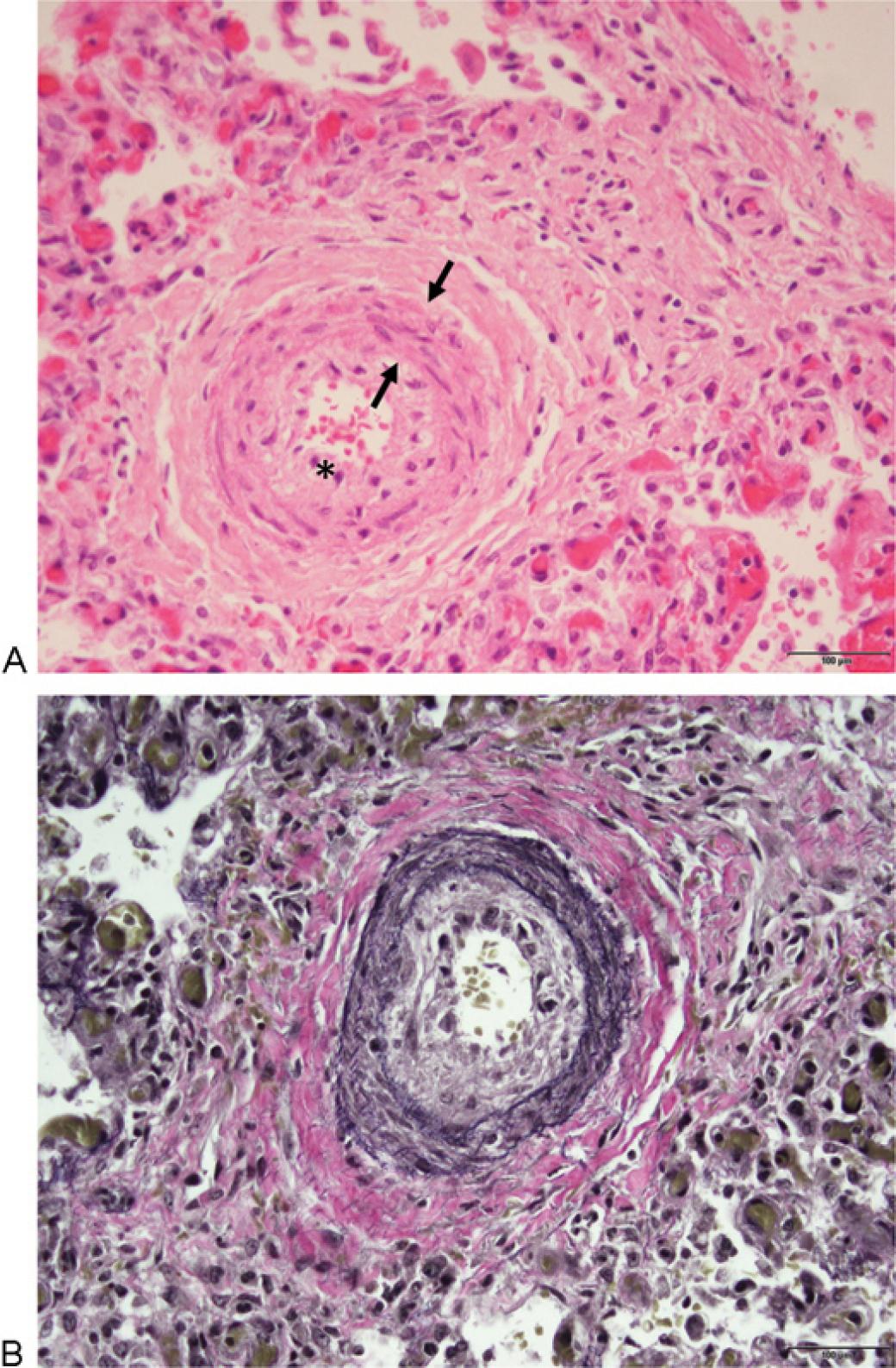 Pediatric and Perinatal Pathology | Pathology
