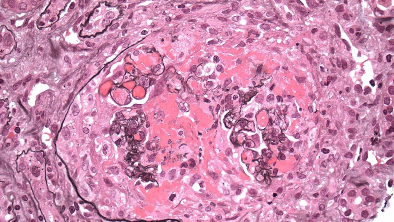 Autopsy And Medical Pathology Pathology