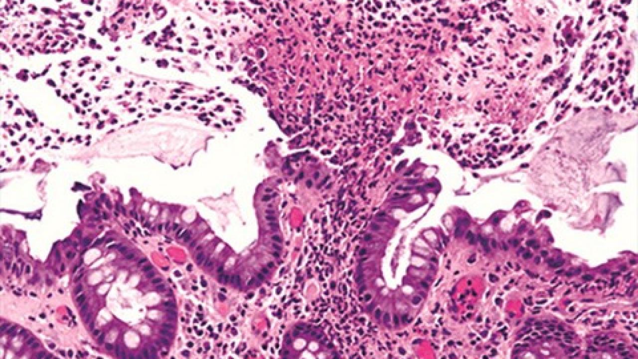 Gastrointestinal, Liver and Pancreas Pathology | Pathology