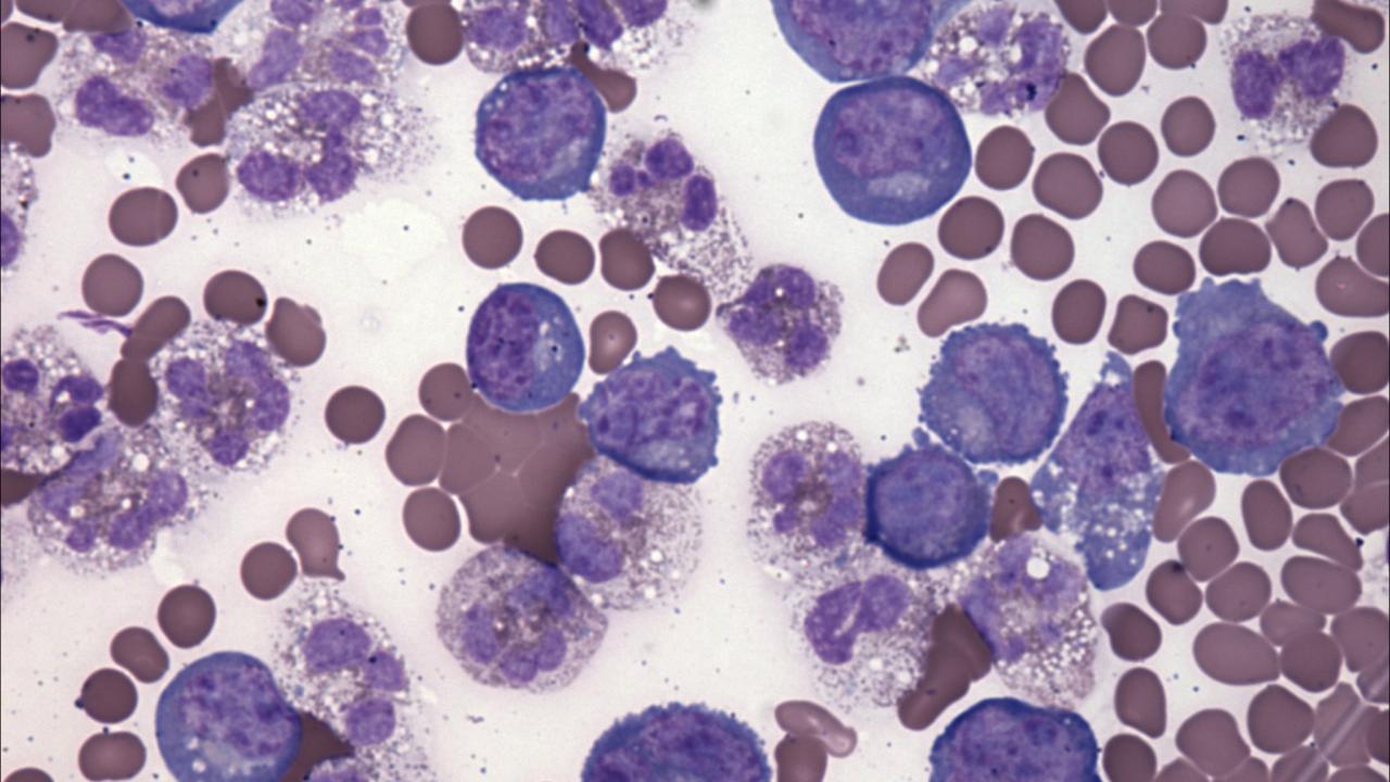 Hematopathology | Pathology