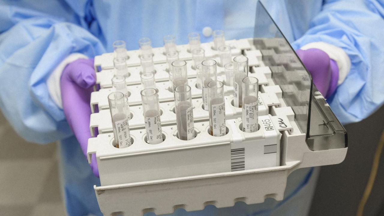 Special Chemistry Laboratory | Pathology