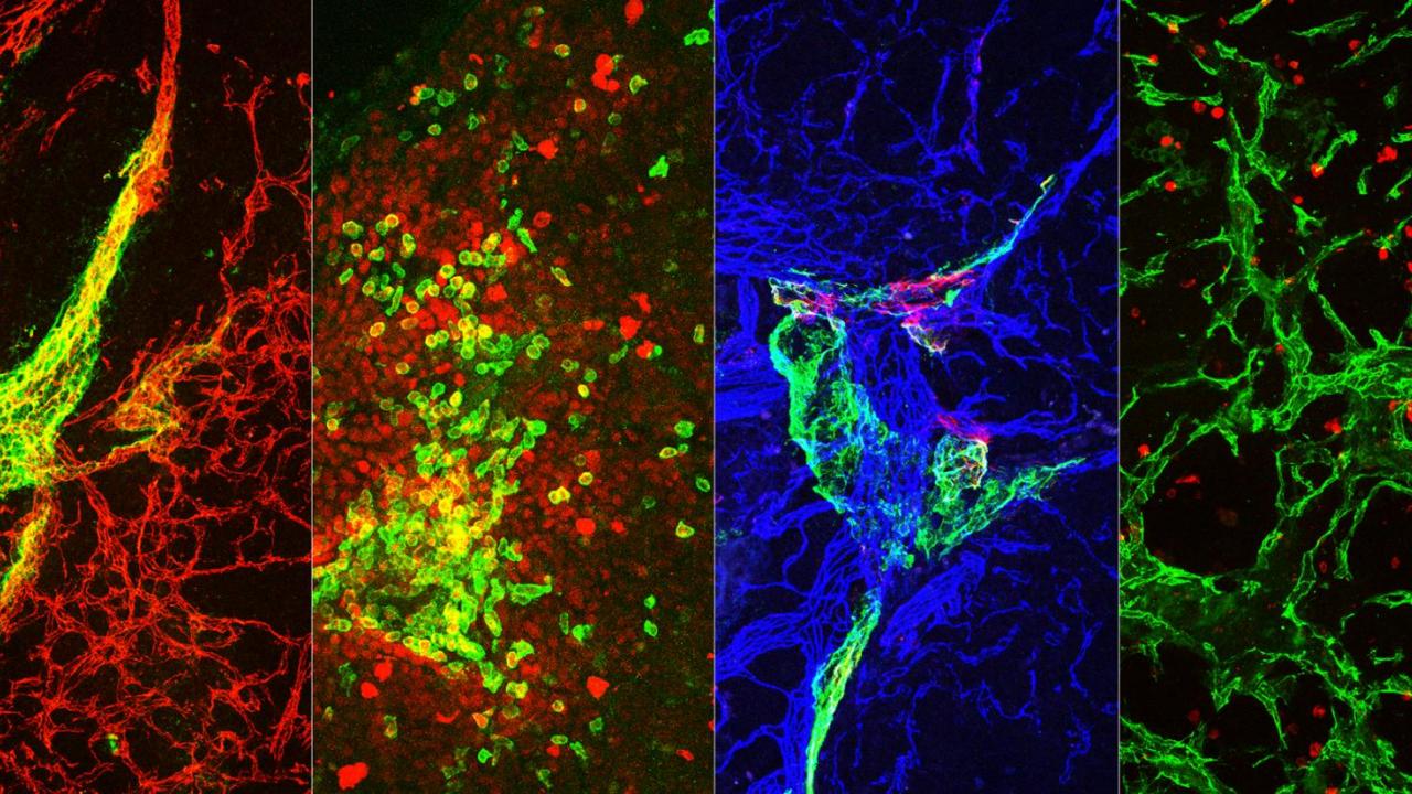 Minah Kim Lab | Pathology