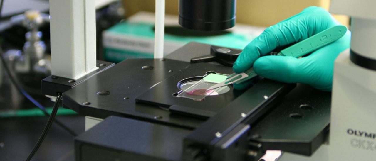 CUIMC Announces New Partnership with Fulgent Genetics | Pathology