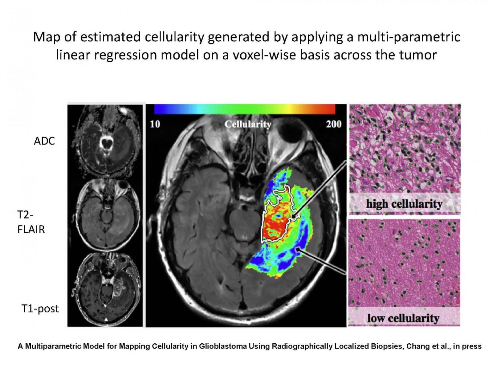 Neuropathology | Pathology