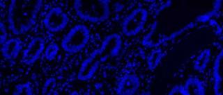 Special Chemistry Laboratory | Pathology