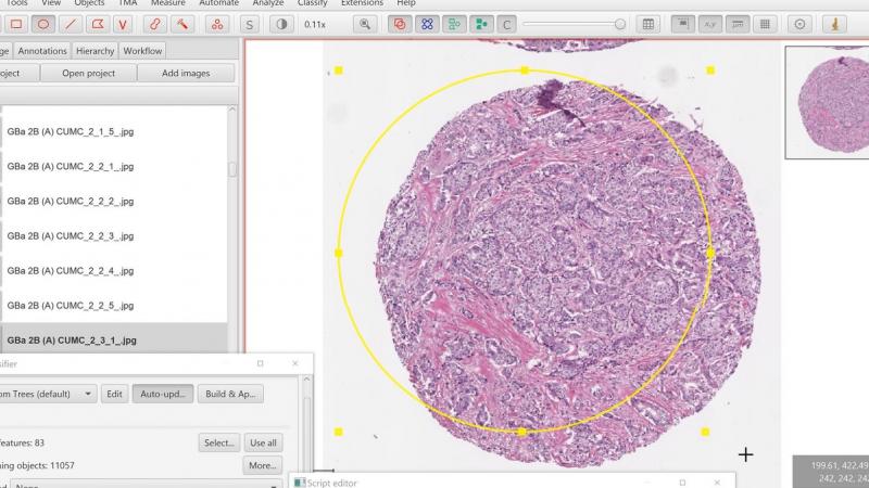 DCPL Learning Center | Digital and Computational Pathology Laboratory ...