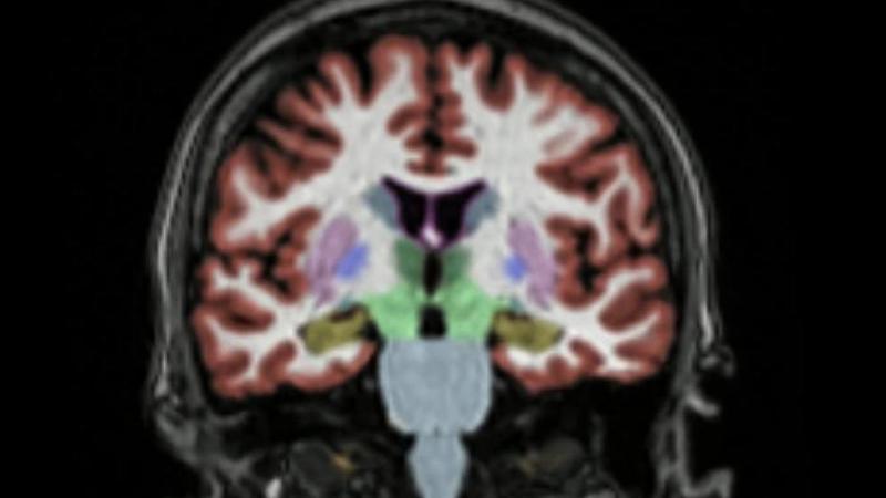 Neurology | Pathology